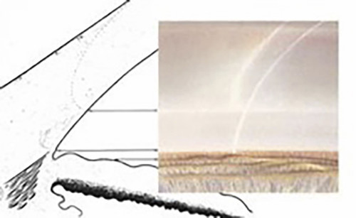Gonioscopy – a closer look at the angle - nzoptics