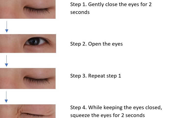 Blinking exercises can make a difference! - nzoptics