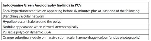 Diagnosis and management of macular polypoidal choroidal vasculopathy ...